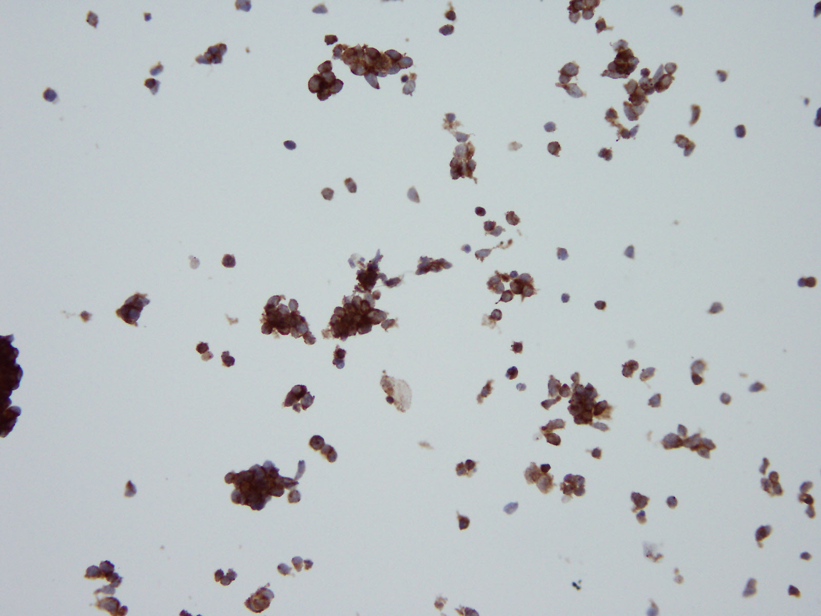 Papanicolaou Society of Cytopathology Case of the Month August 2013