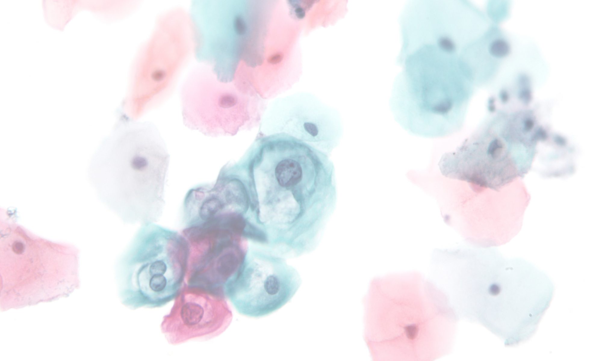 Image Atlas – Papanicolaou Society of Cytopathology